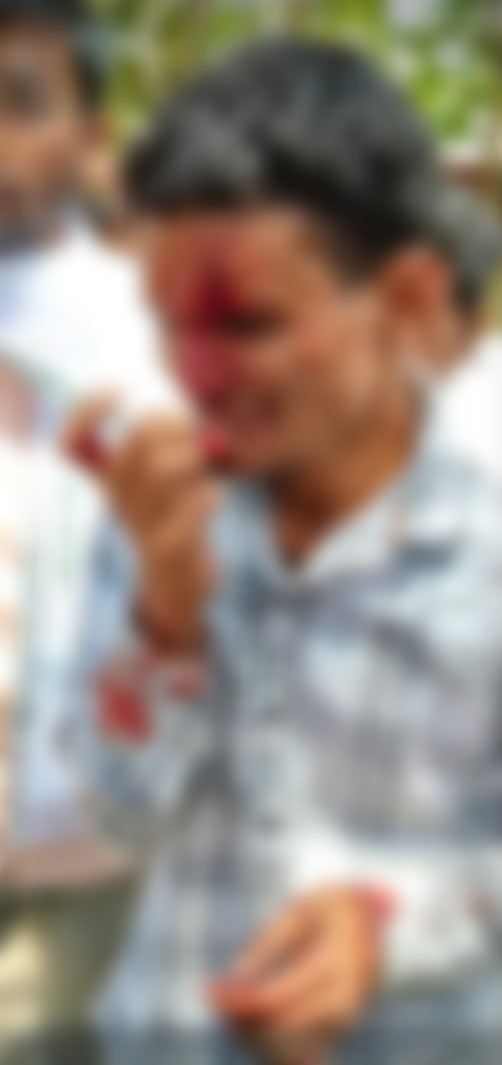 चित्रकूट दिव्यांग विश्वविद्यालय में लाठीचार्ज,संवेदनाओं की हत्या - Jan Expresslive